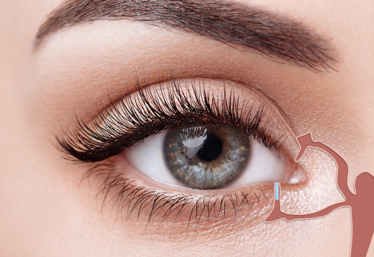 Dry Eye Syndrome in Las Vegas Henderson Centennial NV